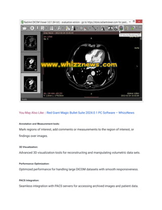 RadiAnt DICOM Viewer 2023.1 PC Software – WhizzNews.pdf
