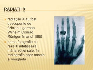 Radiatii x | PPT | Free Download