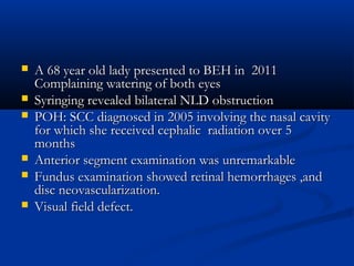 Radiation | PPT