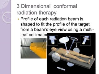 Radiation Therapy | PPTX