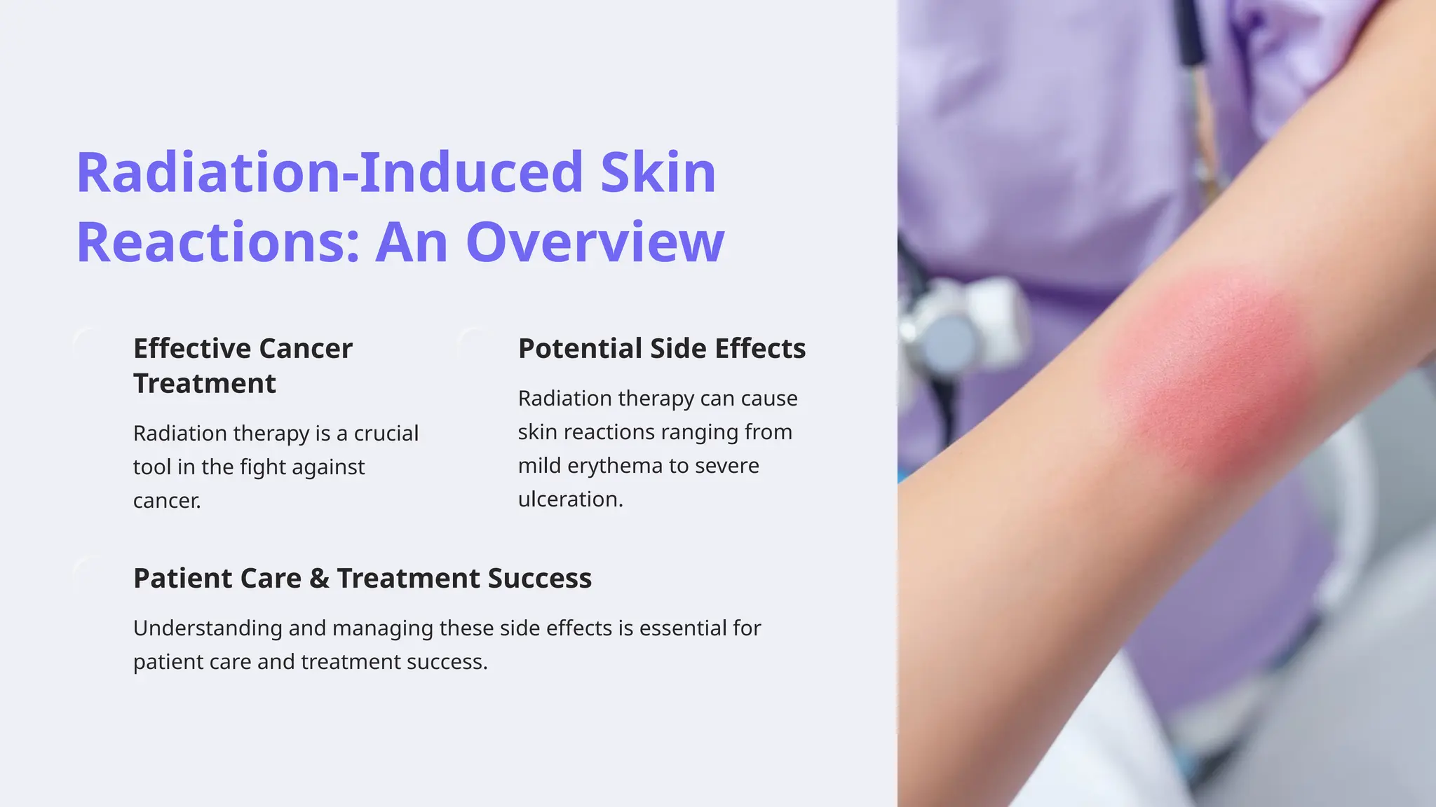 Radiation-Induced-Skin-Reactions-An-Overview (7).pptx