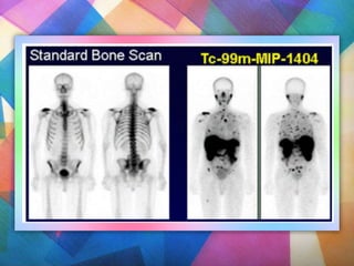 Radiation application | PPT