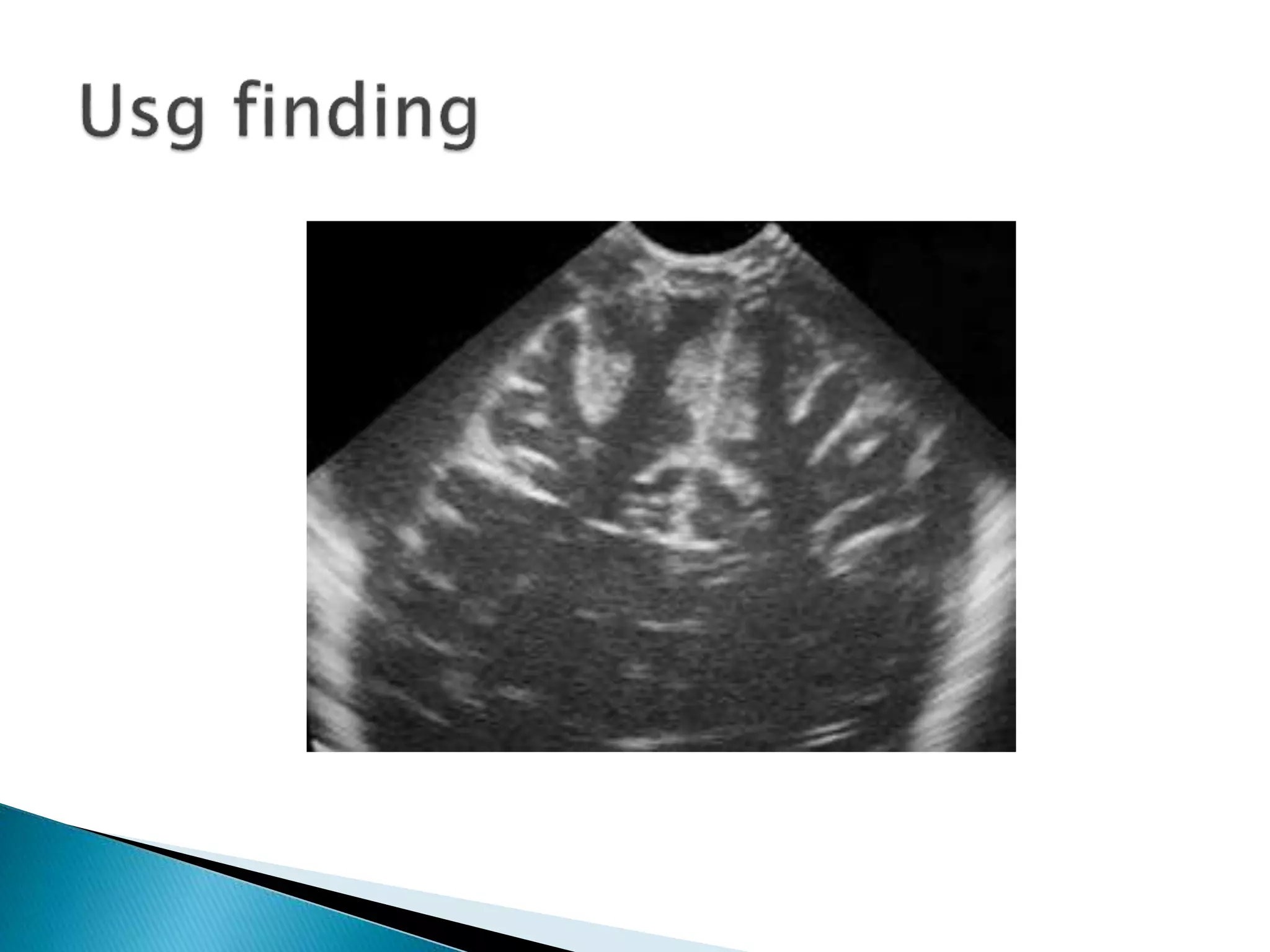 Radiation cystitis MANAGEMNT | PPT