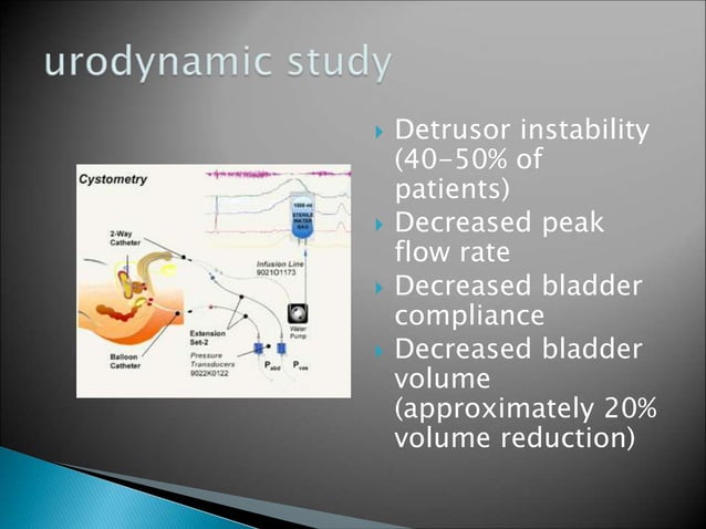 Radiation cystitis MANAGEMNT | PPT