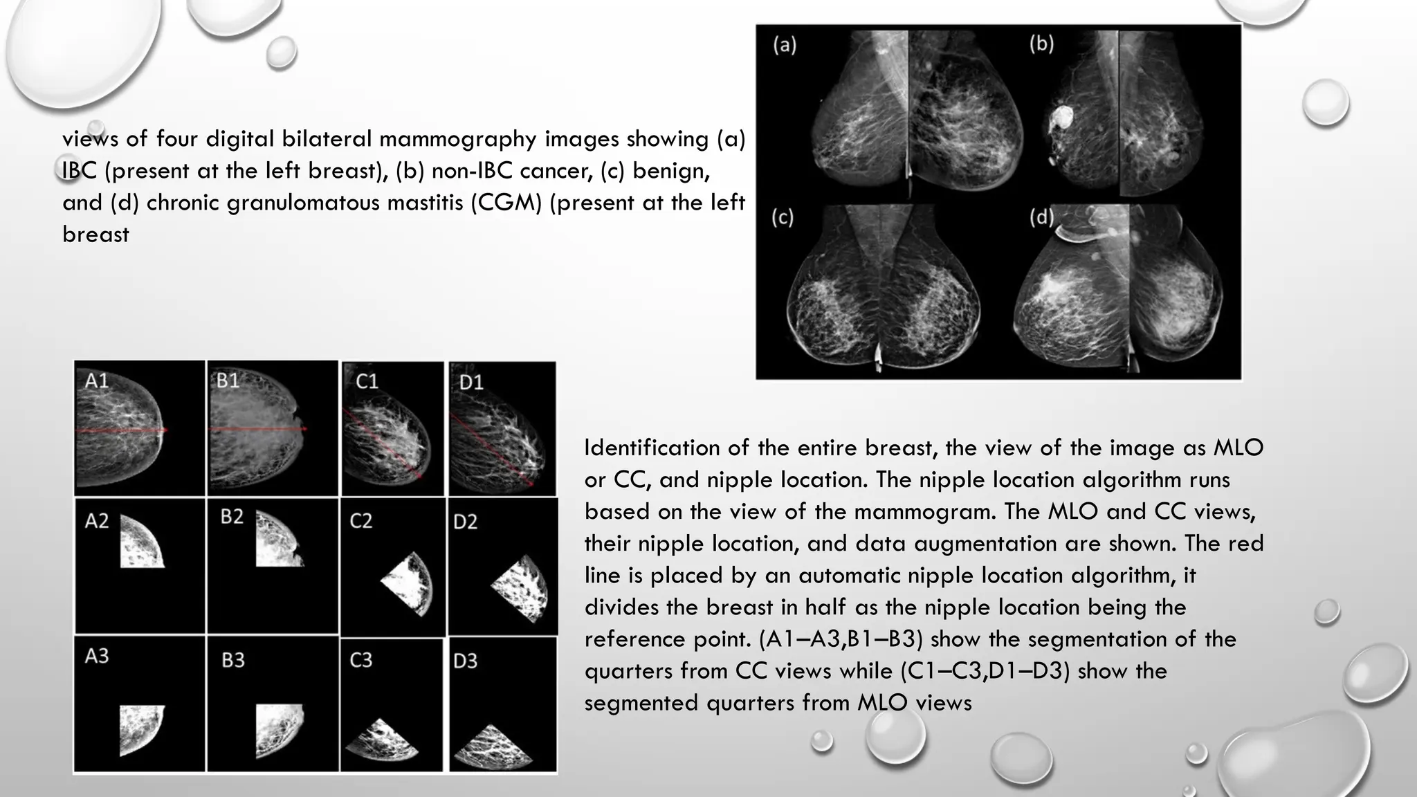 Radiation diagnostics of diseases of the thyroid gland (1).pptx