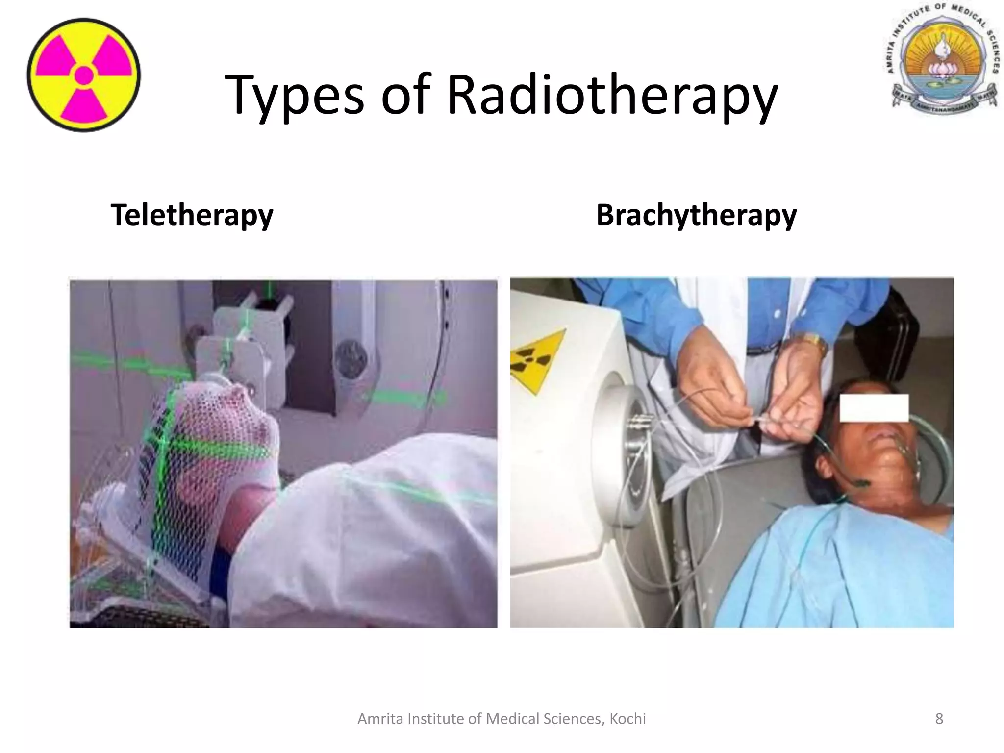 Radiation in oral cancers | PPTX