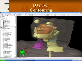 Radiation planning steps | PPT