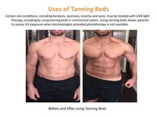 Tanning Beds Before And After Men