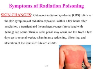 Radiation poisoning | PPT