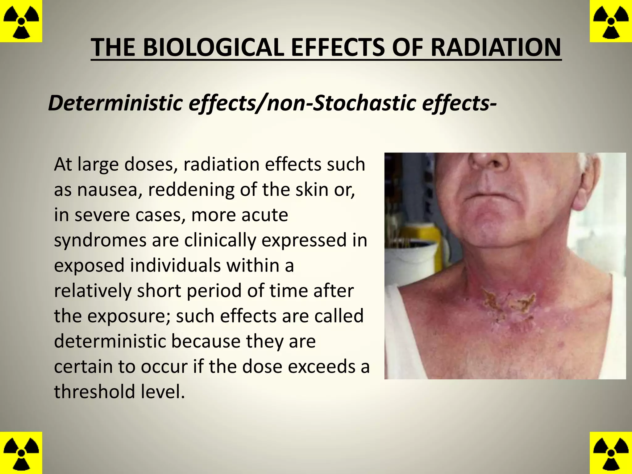 Radiation protection | PPTX