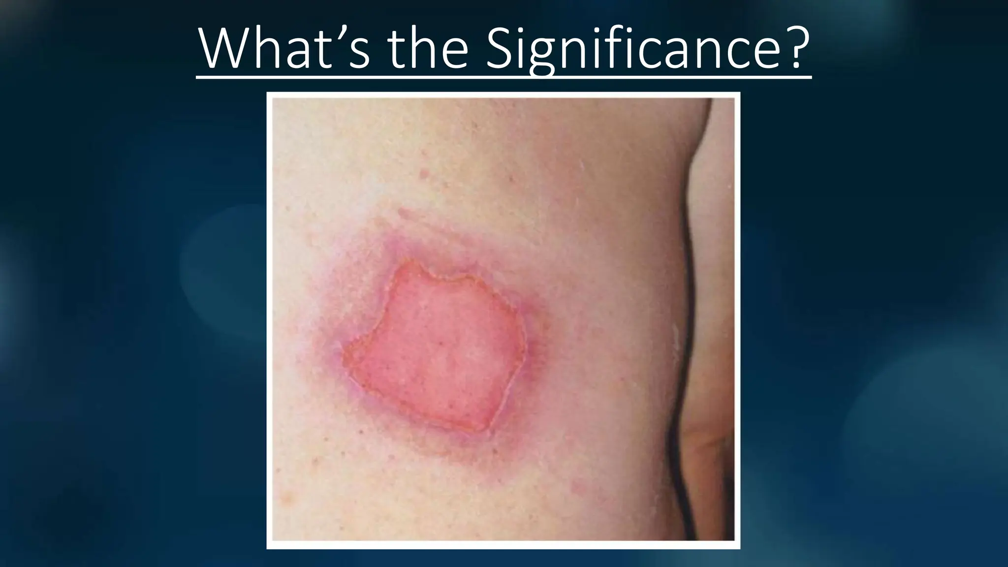 Radiation Protection in the Cardiac Catheterization Lab.pptx