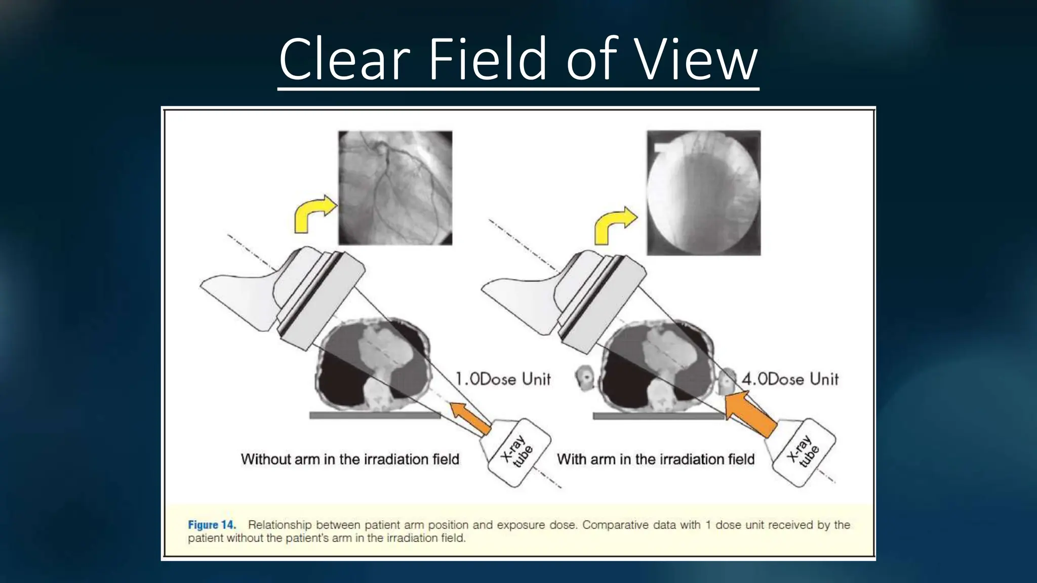 Radiation Protection in the Cardiac Catheterization Lab.pptx