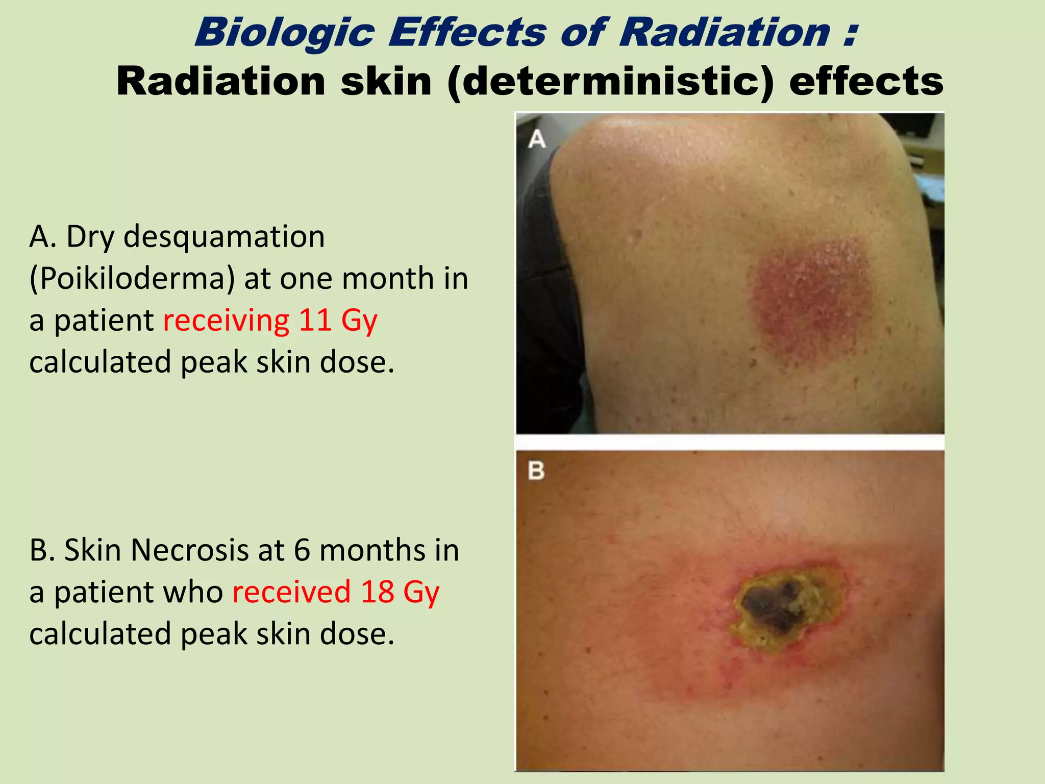 Radiation Safety In The Cath Lab | PPTX