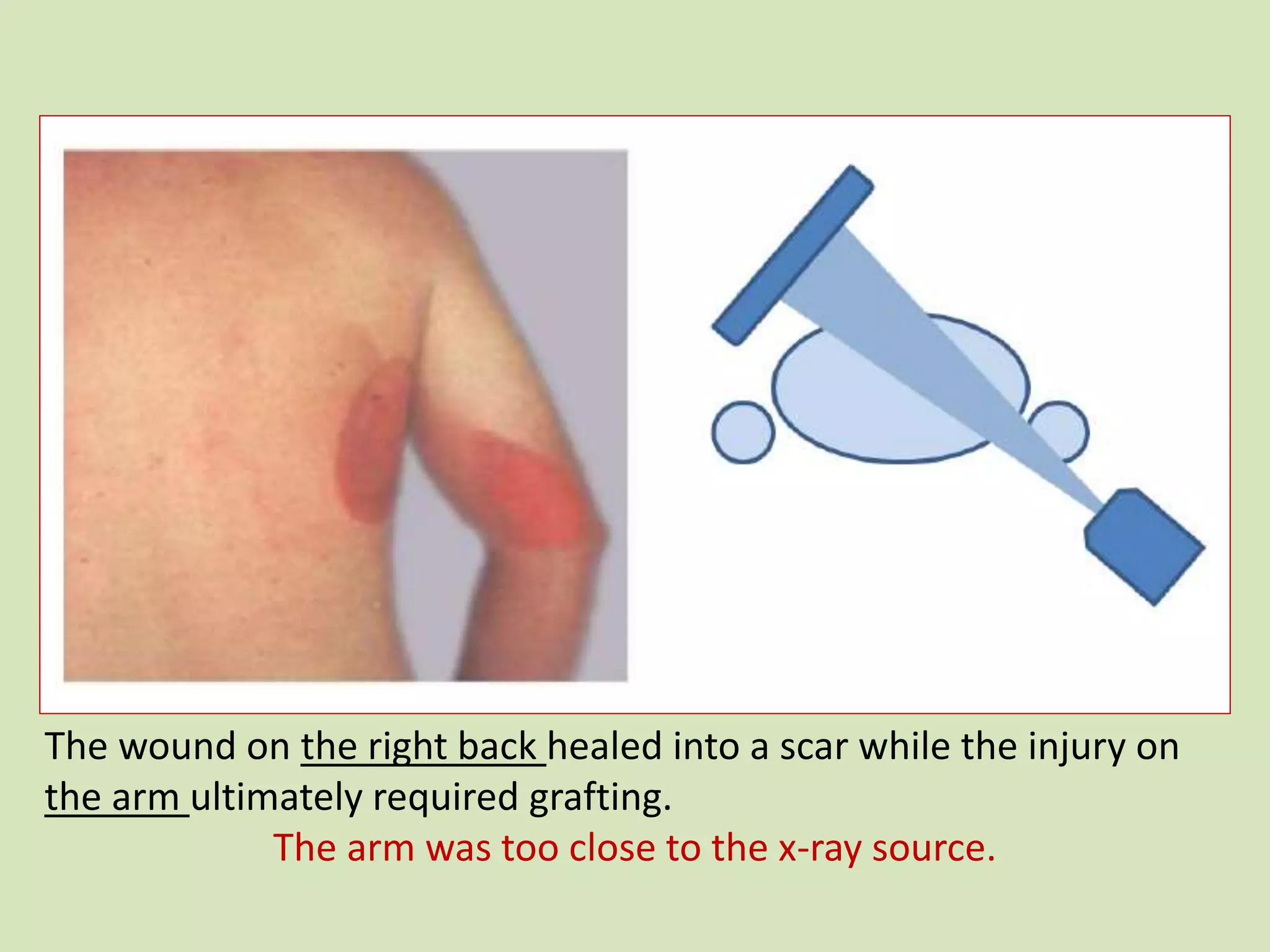 Radiation Safety In The Cath Lab | PPTX