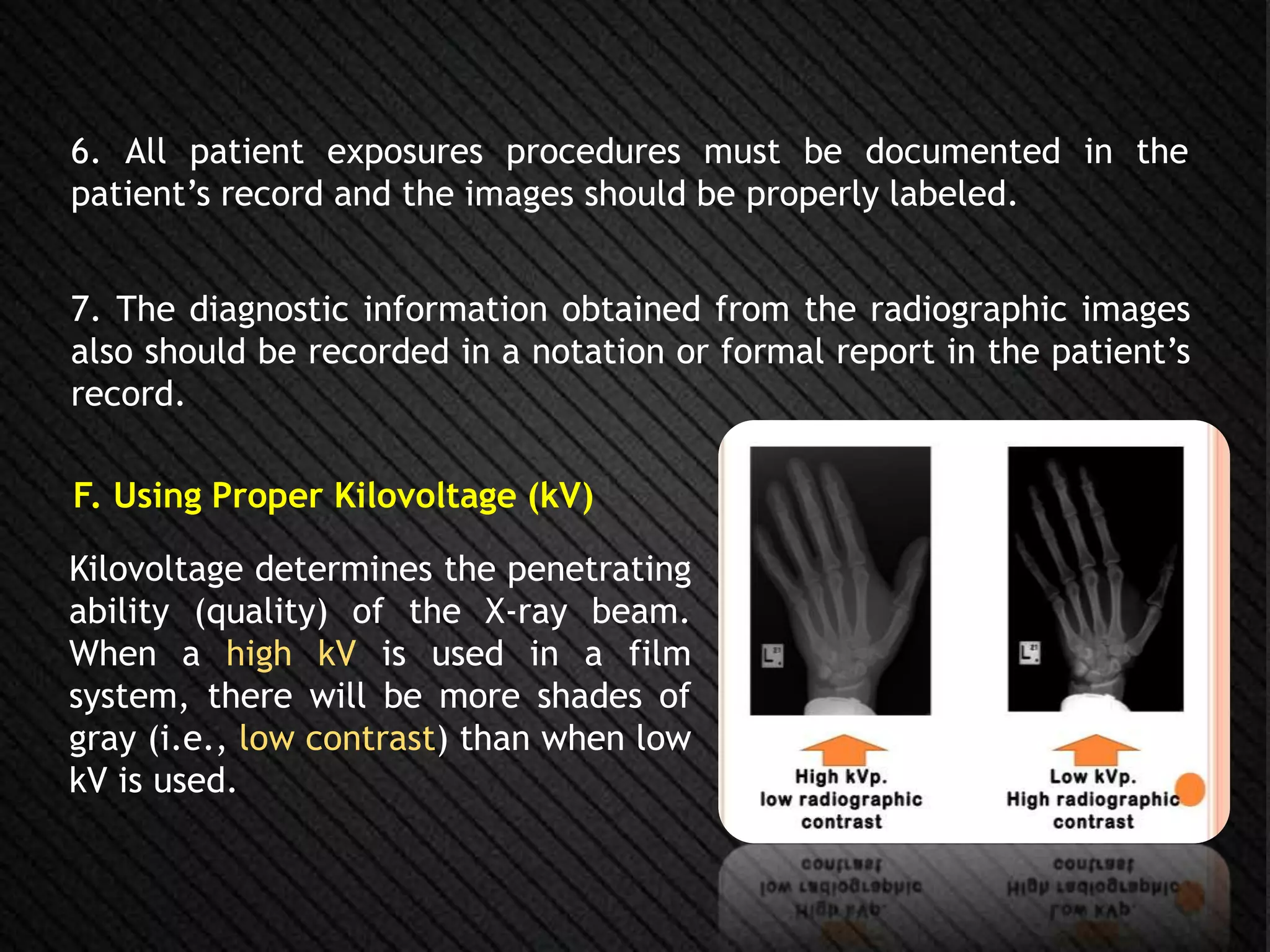 Radiation safety and protection for dental radiography | PPTX