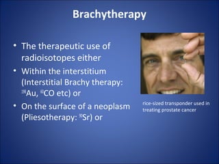 Radiation therapy | PPT