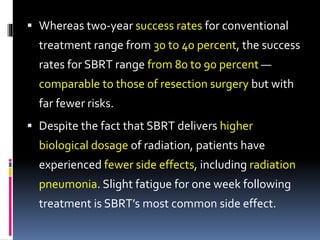 Radiation therapy and Types of Radiation therapy | PPTX