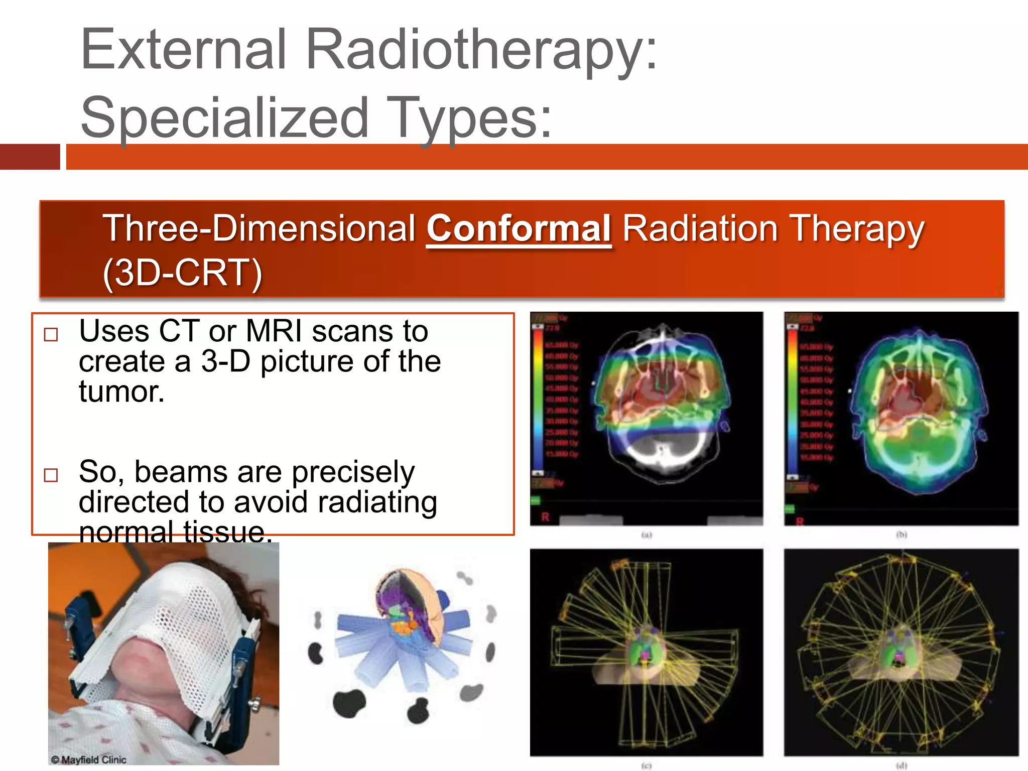 Radiation therapy | PPTX