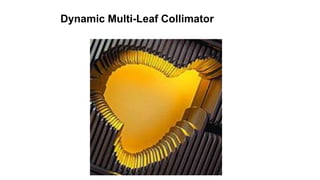 Radiation Therapy for Inflammatory Breast Cancer | PPTX