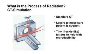 Radiation Therapy for Inflammatory Breast Cancer | PPTX