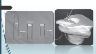 radiation therapy for oral cancer0000.pdf