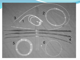 Radiation therapy in Cancer Oesophagus | PPTX