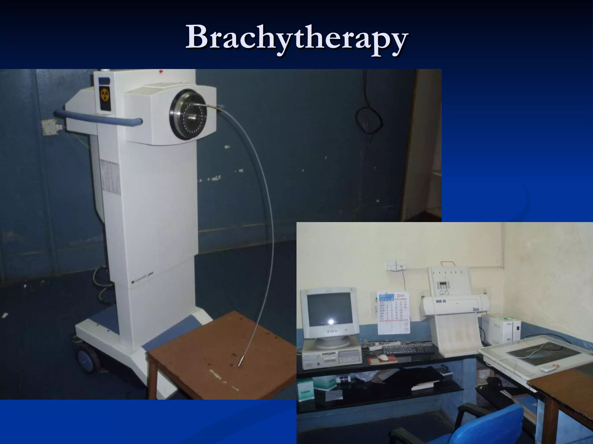 Radiation therapy of oral cancers | PPT