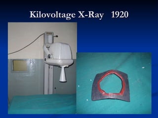 Radiation therapy of oral cancers | PPT