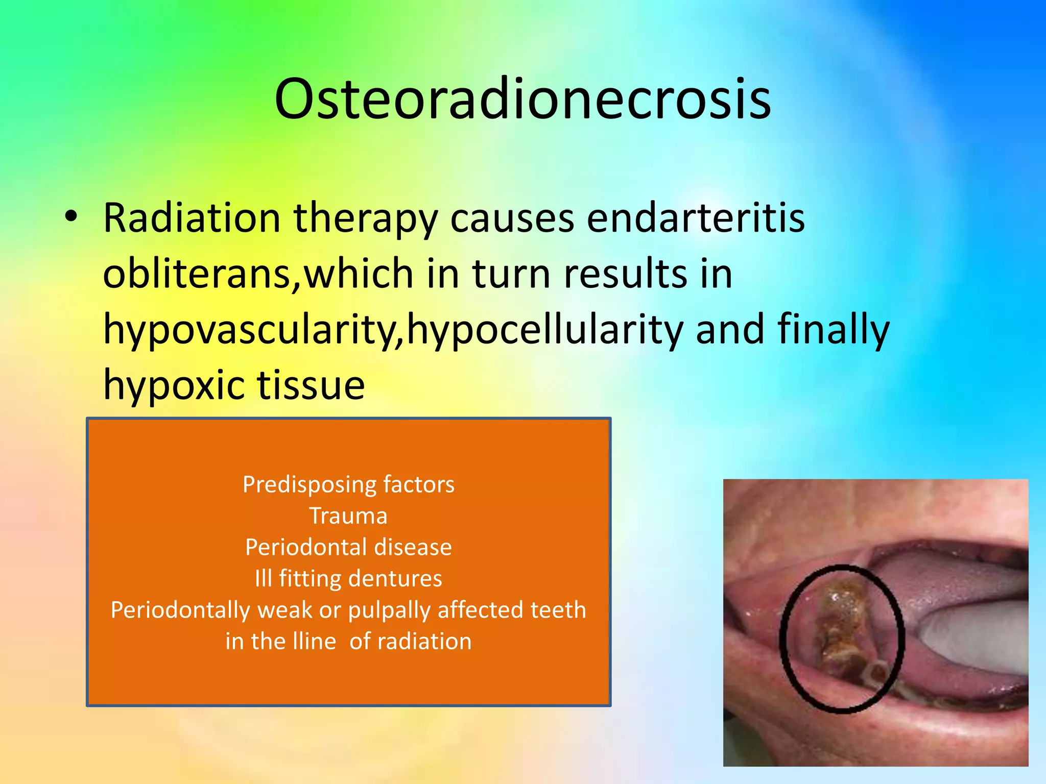 Radiation therapy omfs | PPTX