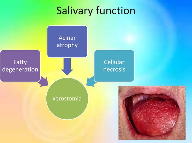 Radiation therapy omfs | PPTX