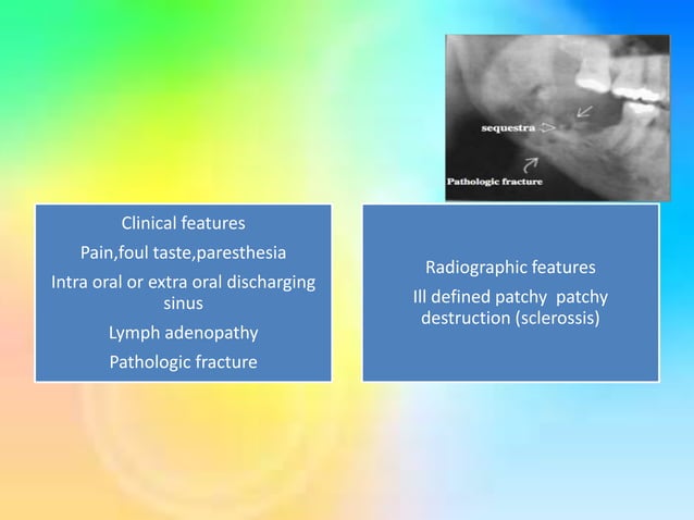 Radiation therapy omfs | PPTX