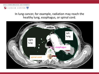 What You Should Know about Radiation Therapy | PPTX