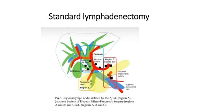 Radical Cholecystectomy.pptx | Digestive Disorders | Diseases and ...