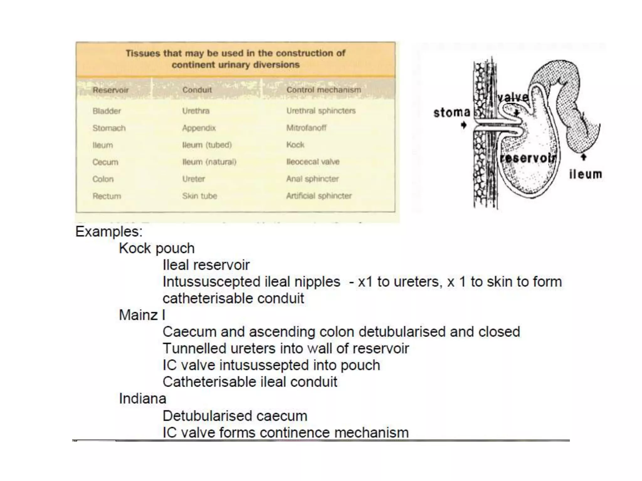 Radical cystectomy | PPTX