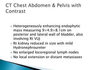 Radical Cystectomy.pptx