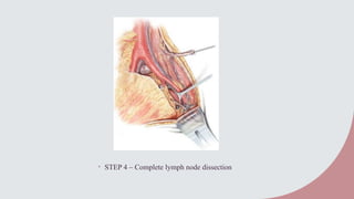 Radical cystectomy for carcinoma bladder | PPTX