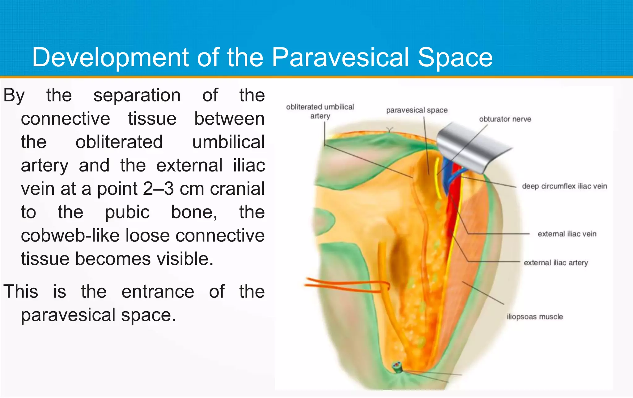 Radical hysterectomy | PPT