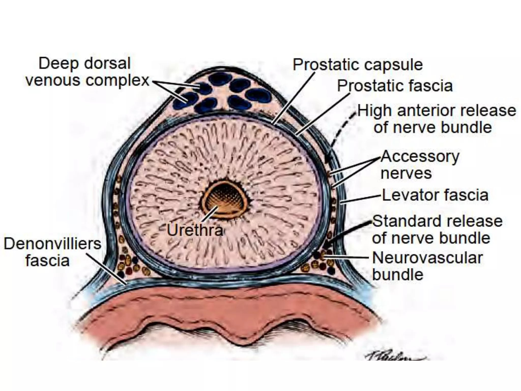 Radical prostatectomy - Surgical anatomy | PPTX | Reproductive Health ...
