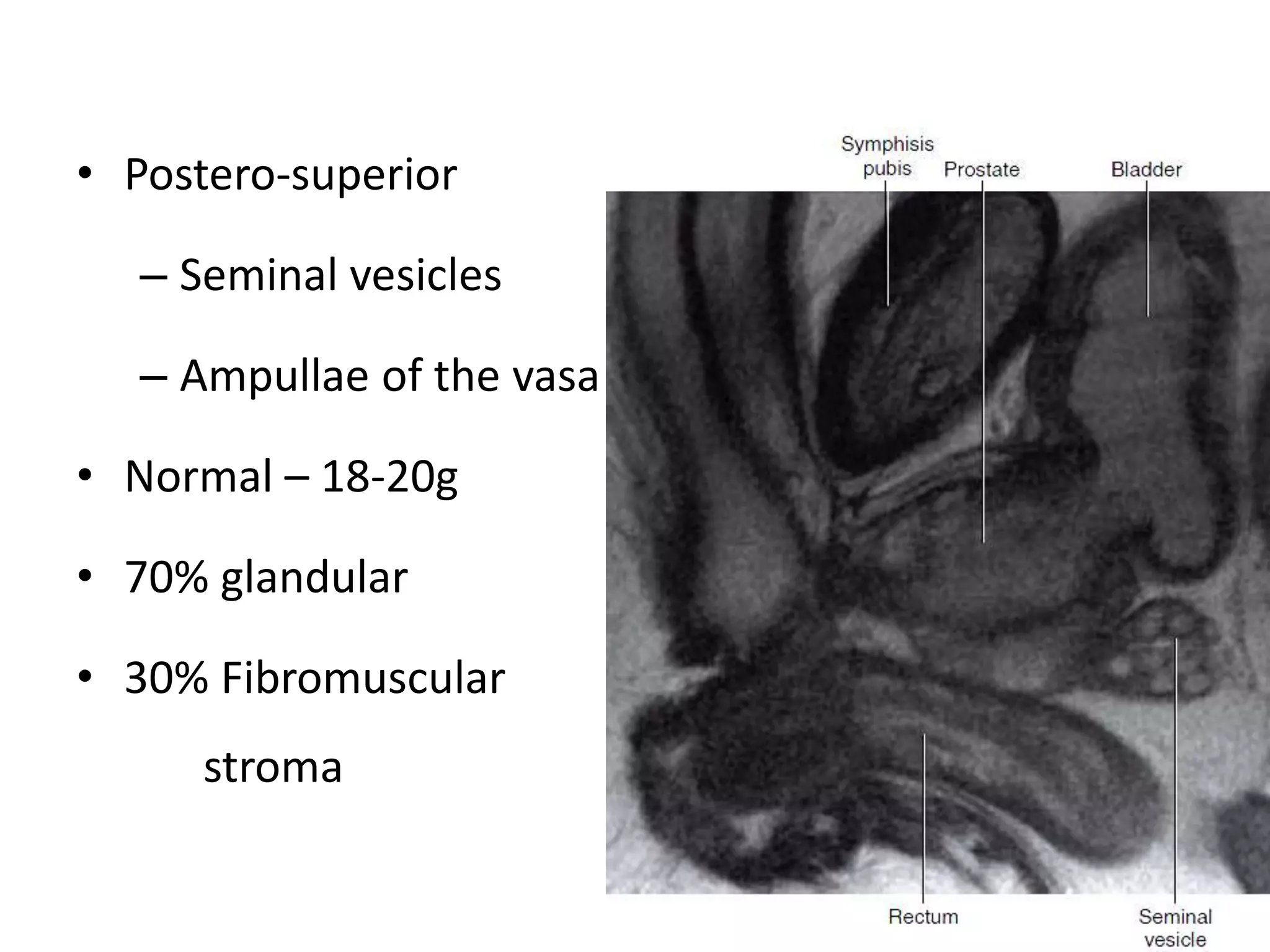 Radical prostatectomy - Surgical anatomy | PPTX