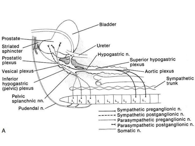 Radical Prostatectomy Surgical Anatomy Ppt