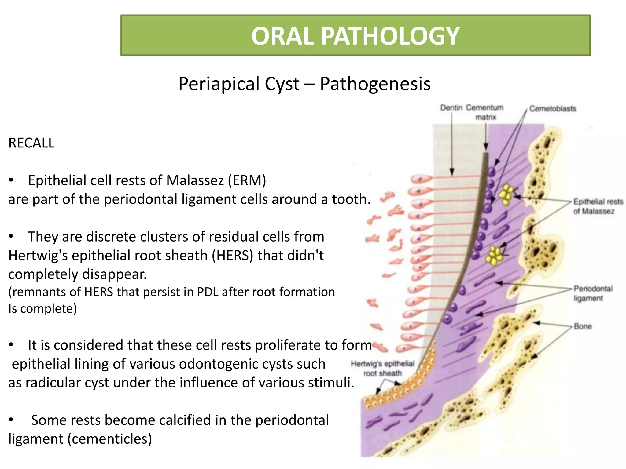Radicular cyst or Periapical cyst | PPTX