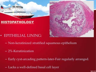 Radicular cyst | PPTX