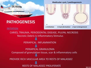 radicularcyst histology treatment n prognosis | PPTX