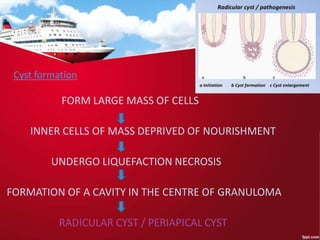 radicularcyst histology treatment n prognosis | PPTX | Dental Health ...