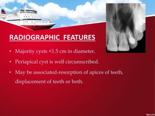 radicularcyst histology treatment n prognosis | PPTX