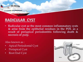 radicularcyst histology treatment n prognosis | PPTX
