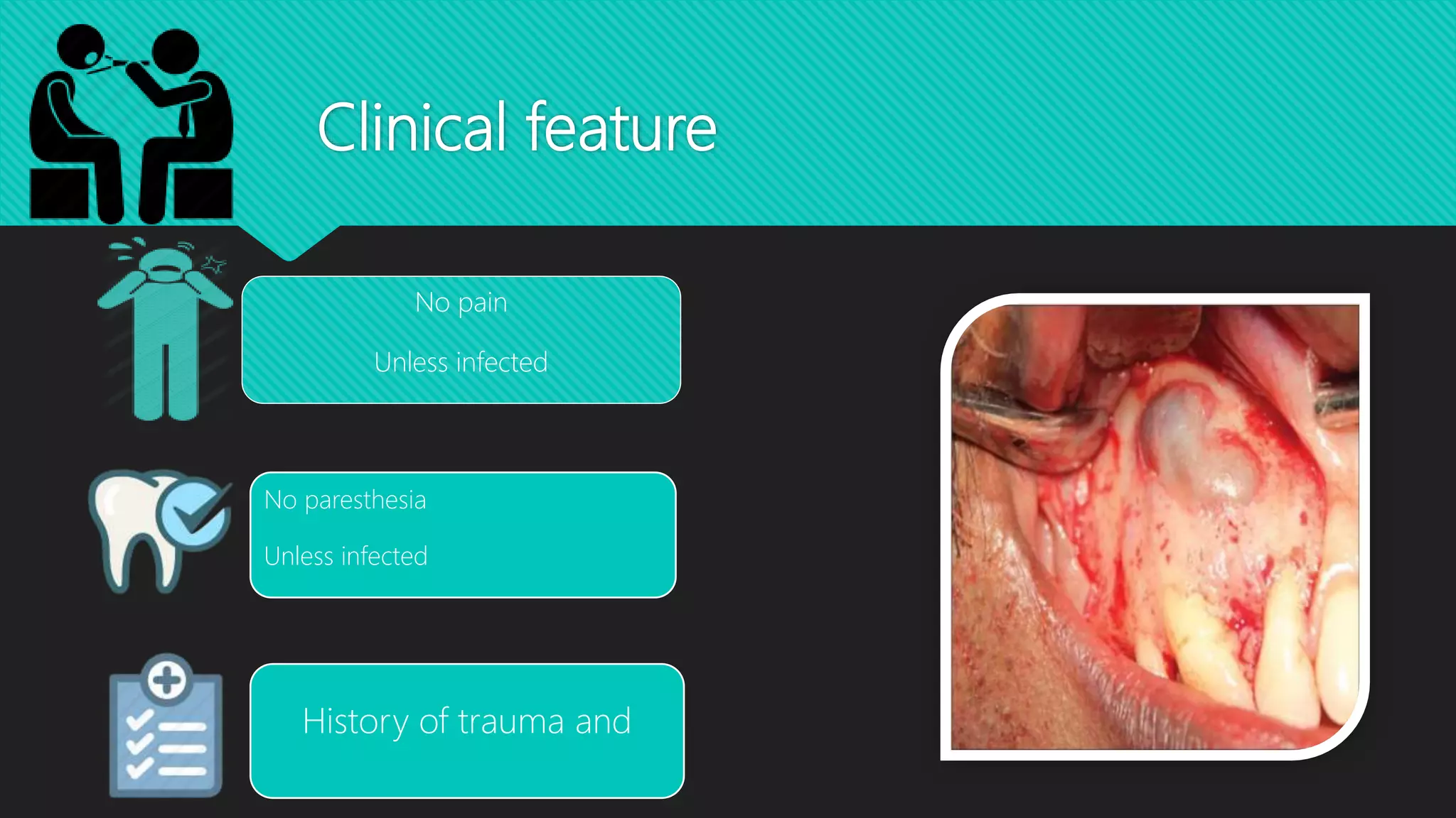 Radicular cyst | PPTX