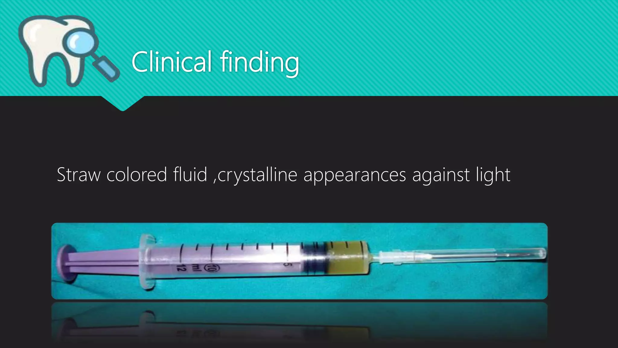 Radicular cyst | PPTX
