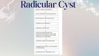 Radicular Cyst Case Presentation - Dentistry.pdf