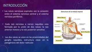 Radiculopatias | PPTX